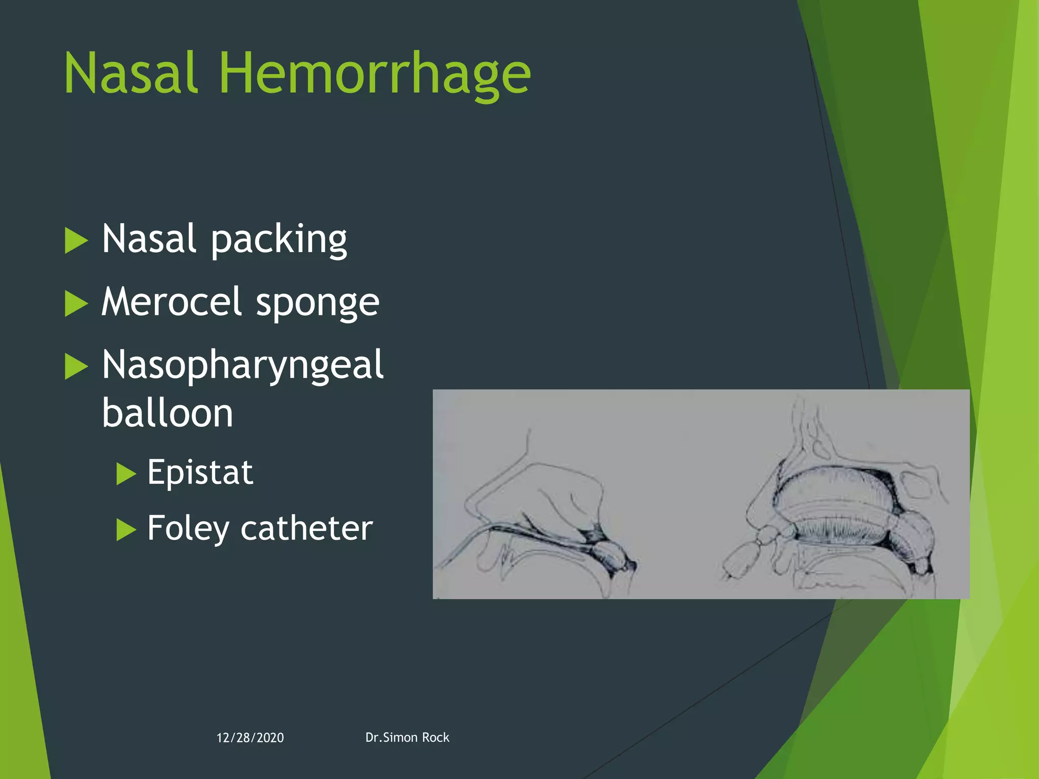 Nasal orbital-ethmoid (noe) fractures | PPT