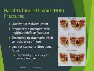Nasal orbital-ethmoid (noe) fractures | PPT