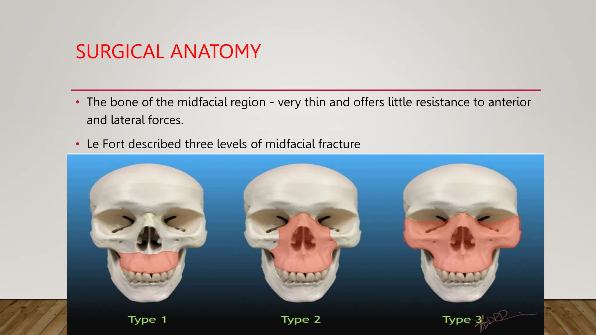 NASAL AND FACIAL FRACTURE copy.pptxphfjp | PPT