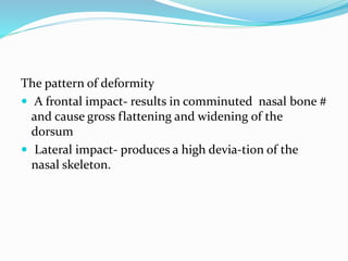 Nasal and facial fractures | PPTX