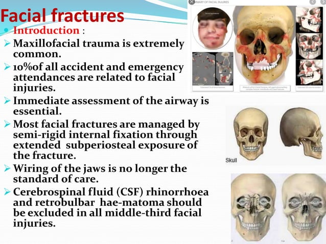 Nasal and facial fractures | PPTX