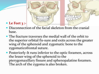 Nasal and facial fractures | PPTX