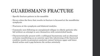 NASAL FRACTURES AND FACIAL FRACTURES.pptx