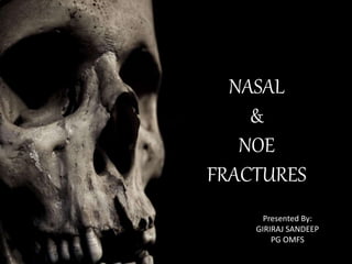 Nasal and noe fractures | PPTX