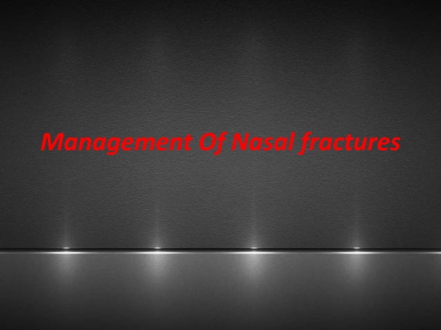 Nasal and noe fractures | PPTX