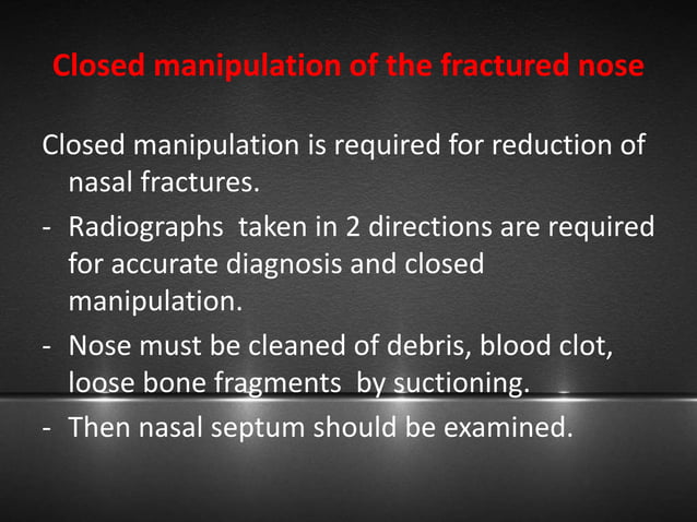 Nasal and noe fractures | PPTX