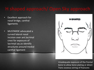 Nasal and noe fractures | PPT