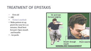 NASAL BLEED.pptx
