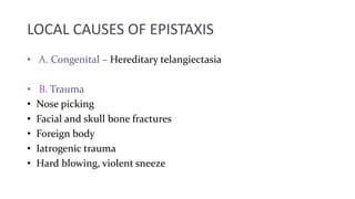 NASAL BLEED.pptx
