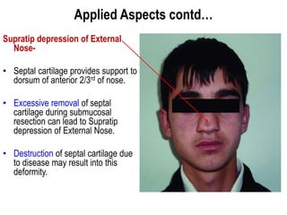 nasal_cavity human anatomy lateral wall and venous drainage_1.pptx