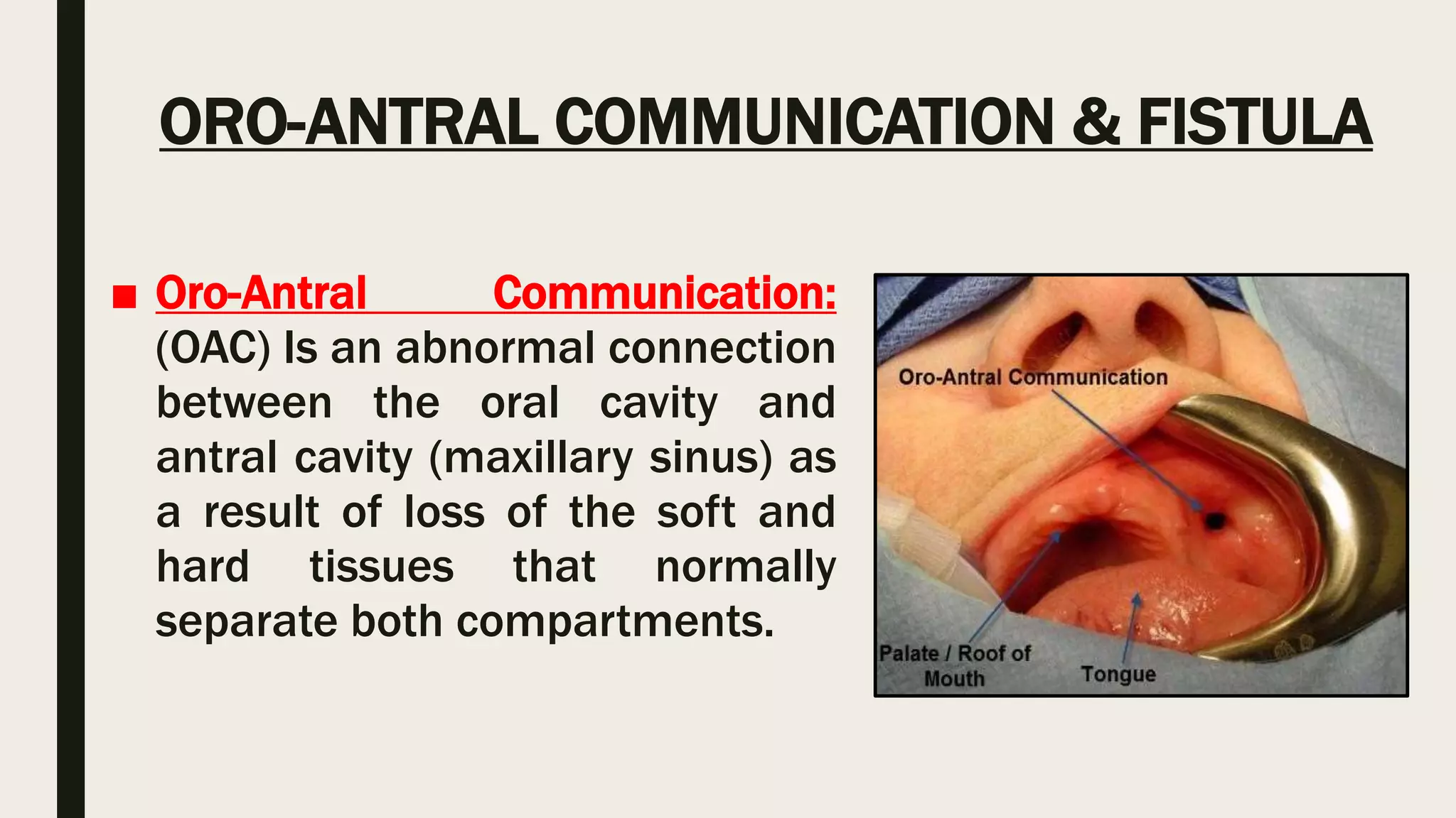 Nasal cavity and paranasal sinuses | PPTX