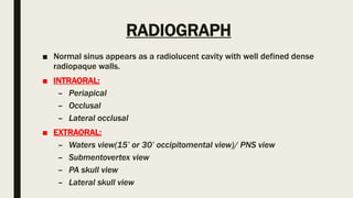 Nasal cavity and paranasal sinuses | PPTX