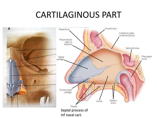 NASAL CAVITY & PNS paranasal air sinuses.pptx | Ear, Nose and Throat Conditions | Diseases and ...