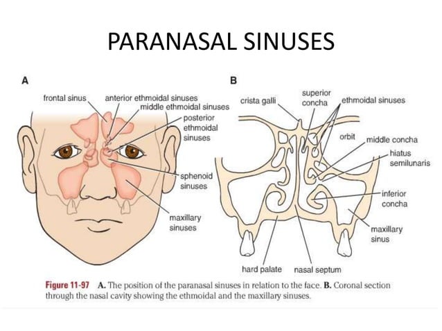 NASAL CAVITY & PNS paranasal air sinuses.pptx | Ear, Nose and Throat Conditions | Diseases and ...