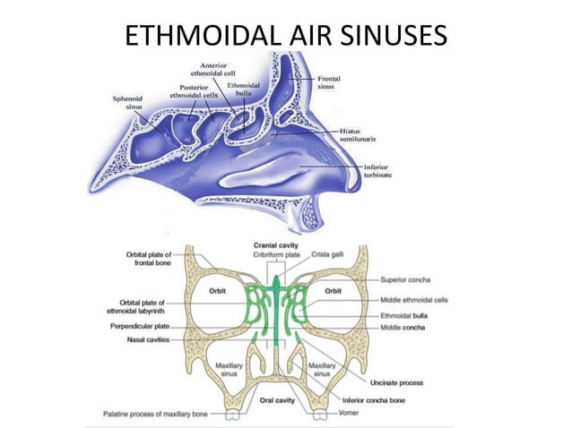 NASAL CAVITY & PNS paranasal air sinuses.pptx | Ear, Nose and Throat Conditions | Diseases and ...