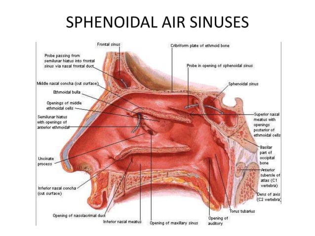 NASAL CAVITY & PNS paranasal air sinuses.pptx | Ear, Nose and Throat Conditions | Diseases and ...