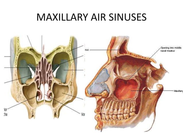 NASAL CAVITY & PNS paranasal air sinuses.pptx | Ear, Nose and Throat Conditions | Diseases and ...