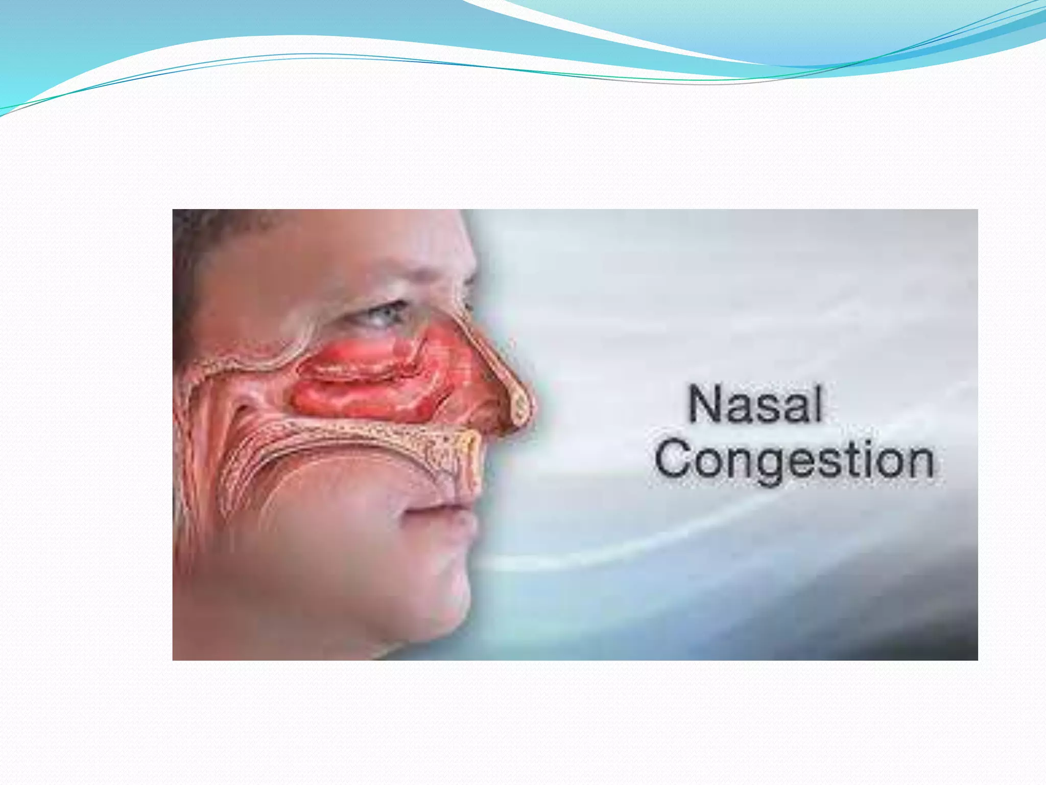 Nasal decongestants | PPTX