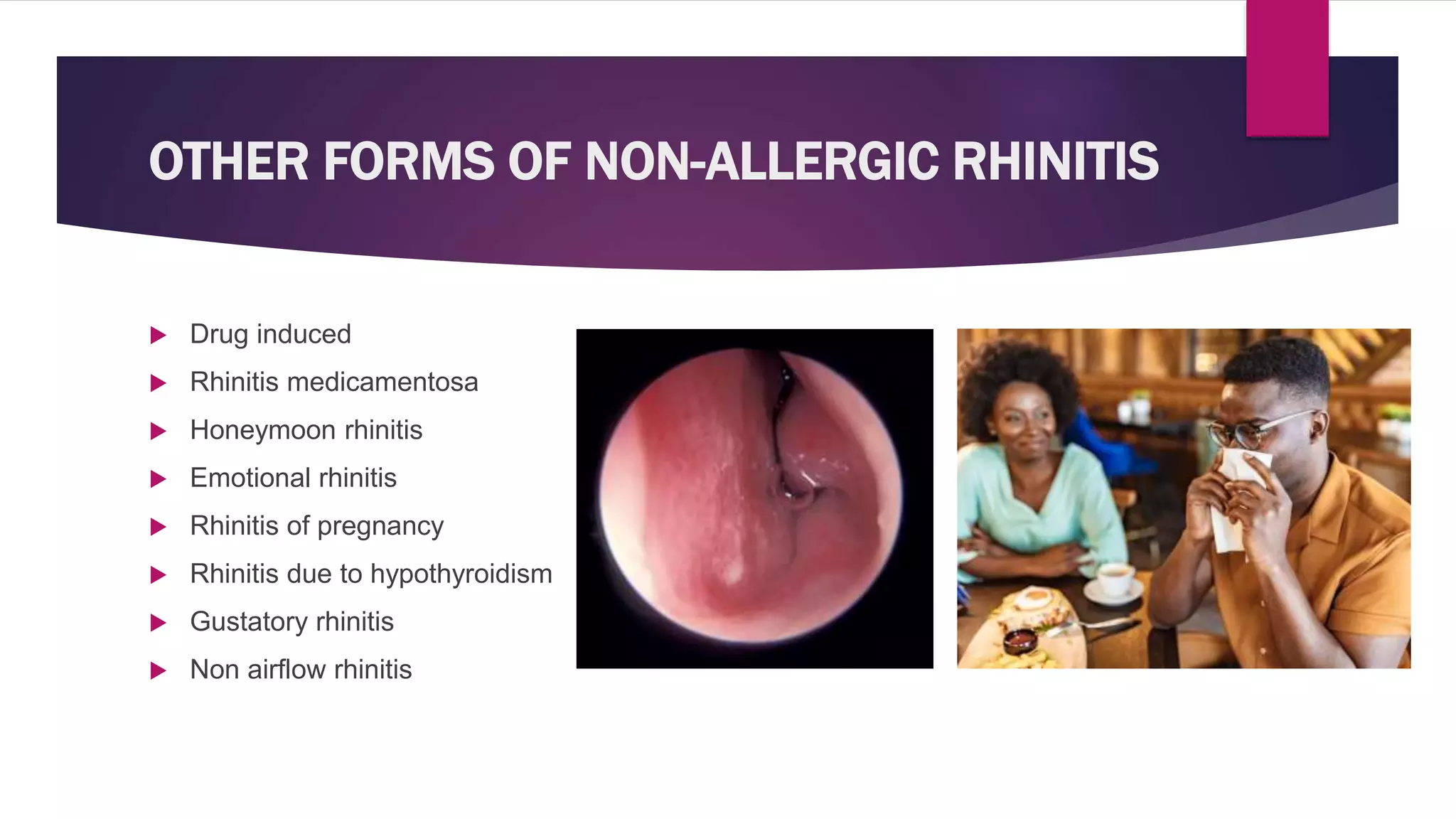 Nasal Discharge - ENT | PPTX