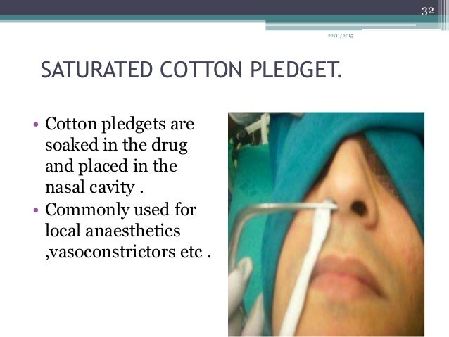 Nasal drug delivery sysems