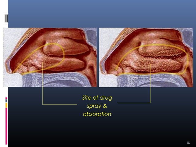 Nasal drug delivery system | PPT | Lung and Respiratory Health ...