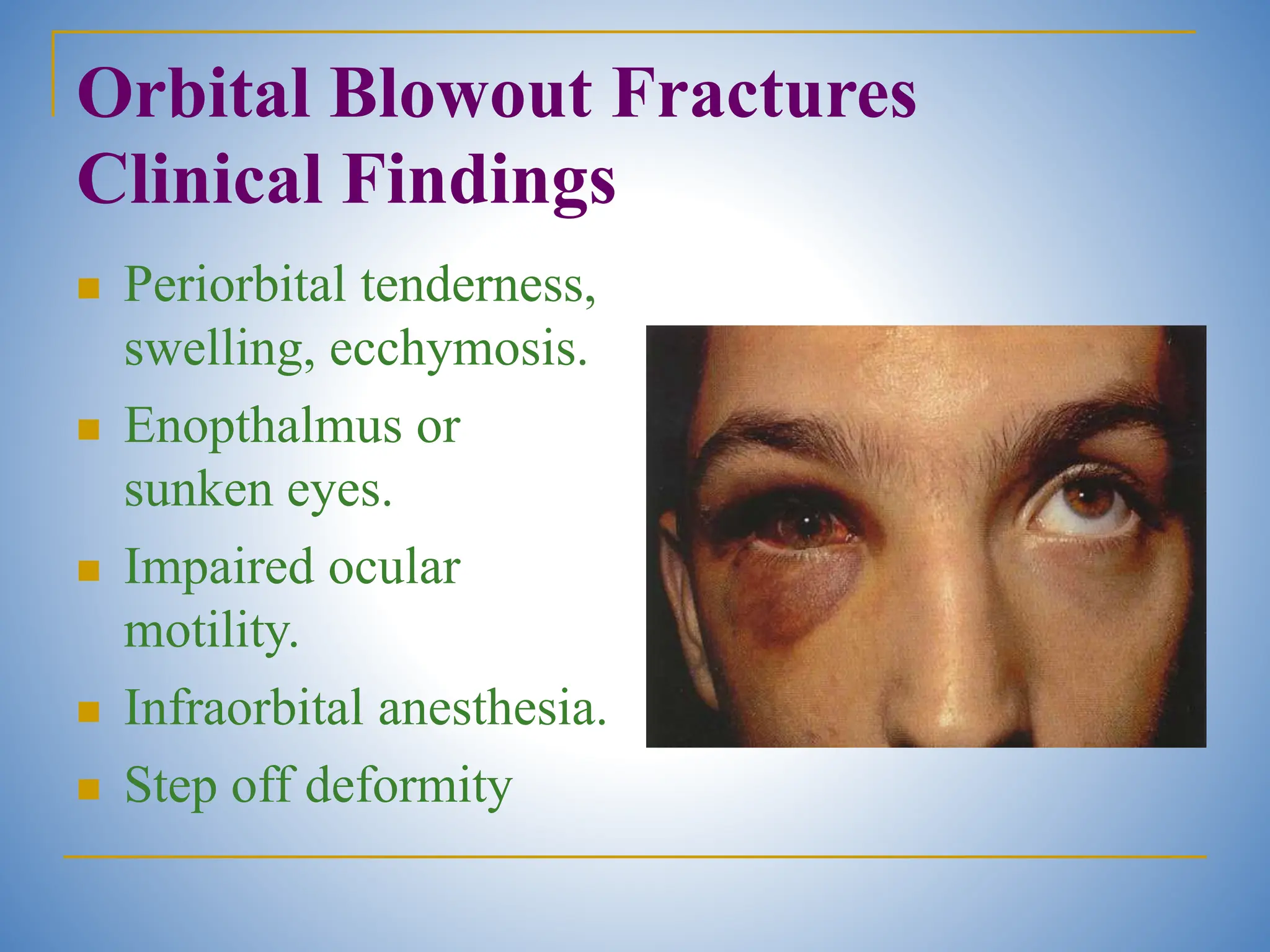Nasal and Facial fracture ( under graduate) | PPTX