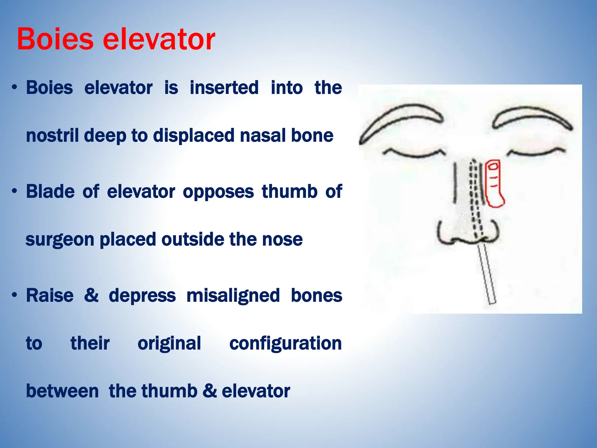 Nasal & Facial Injuries ug.............. | PPTX