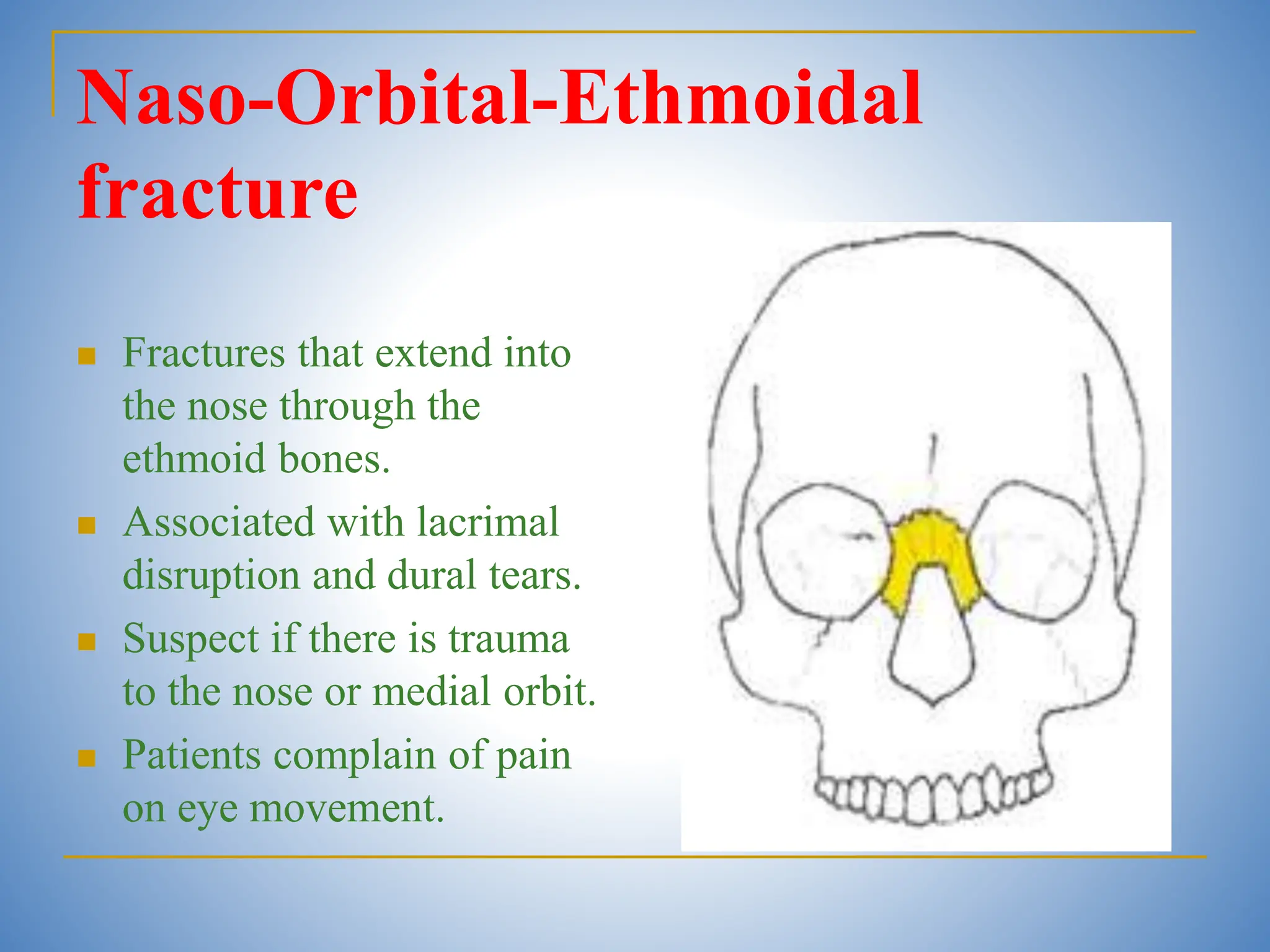 Nasal & Facial Injuries ug.............. | PPTX