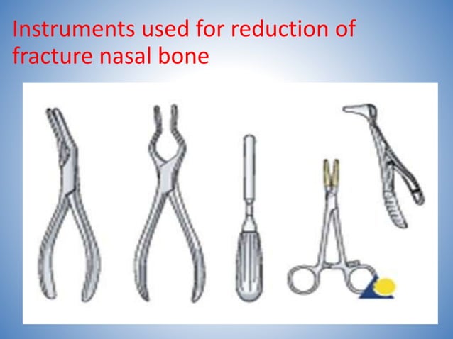Nasal And Facial Injuries Ug Ppt