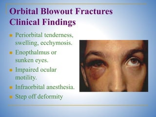 Nasal & Facial Injuries ug.............. | PPTX