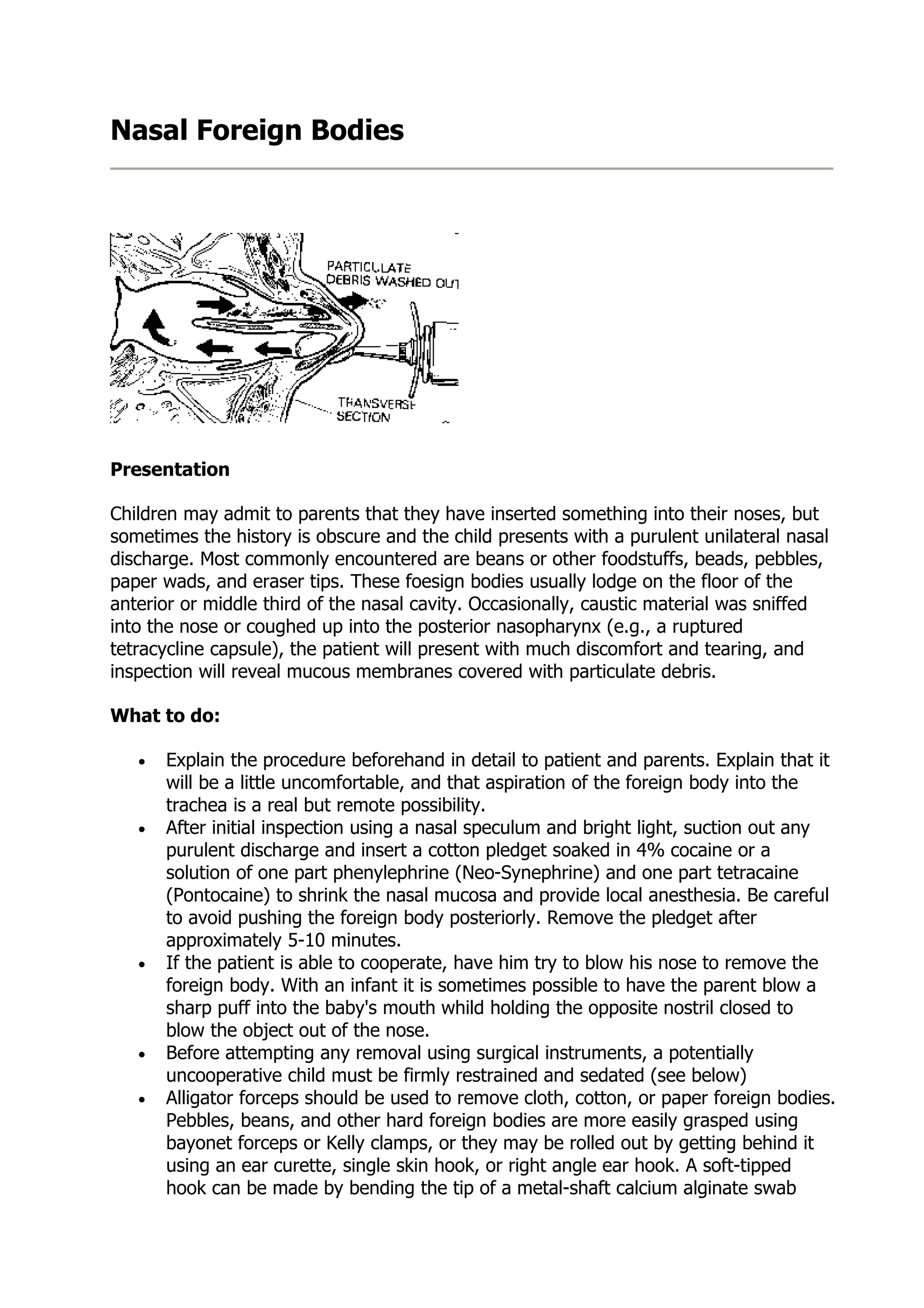 Nasal Foreign Bodies | DOC