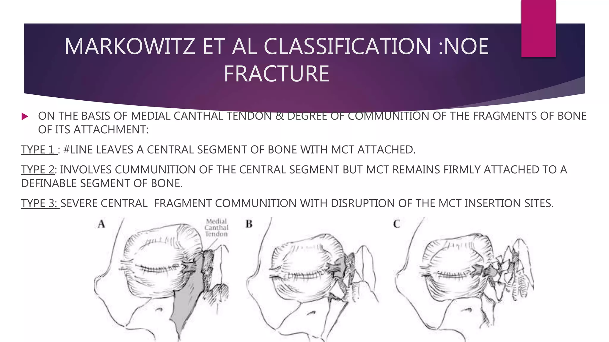 Nasal fracture ent ppt | PPTX