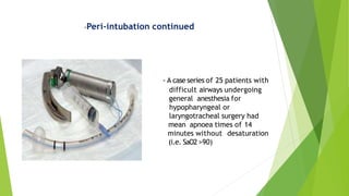 #Nasal high flow | PPTX