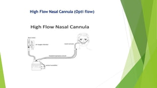 #Nasal high flow | PPTX