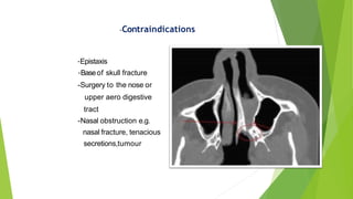 #Nasal high flow | PPTX