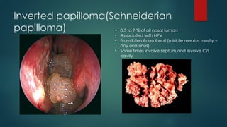 NASAL MASTYUHKFTUYGOLKIYHVKUYS PART 1.pptx