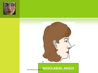 Nasal morphology /certified fixed orthodontic courses by Indian dental ...