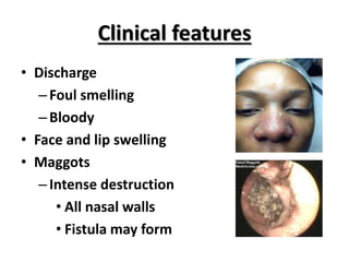 Nasal Myiasis | PPTX