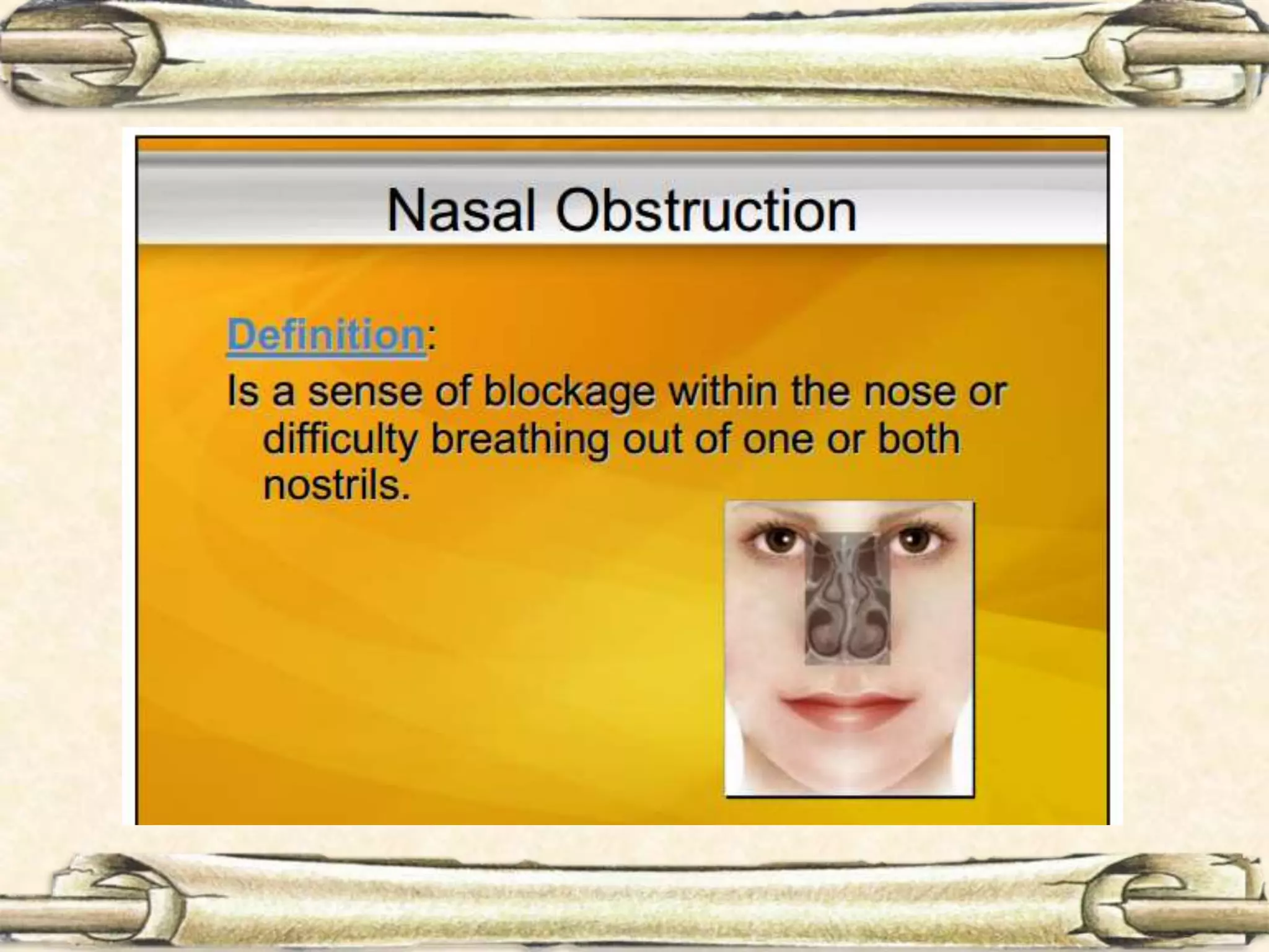 Nasal obstruction | PPTX