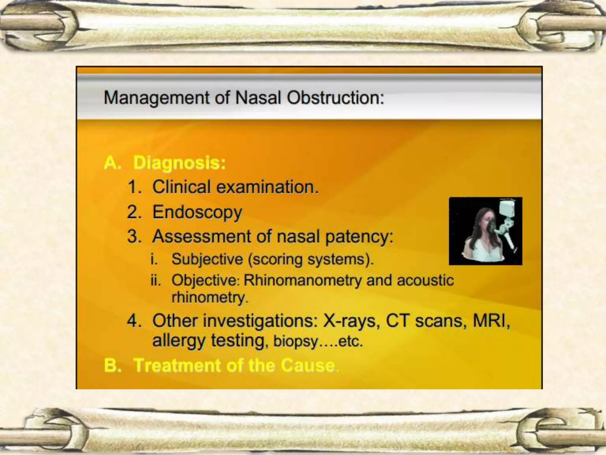 Nasal obstruction | PPTX