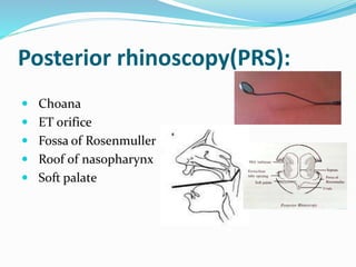 Nasalobstruction | PPTX