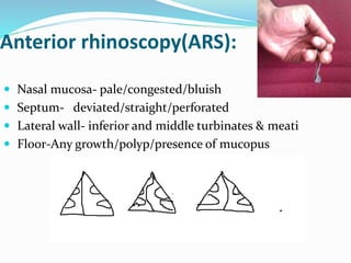Nasalobstruction | PPTX