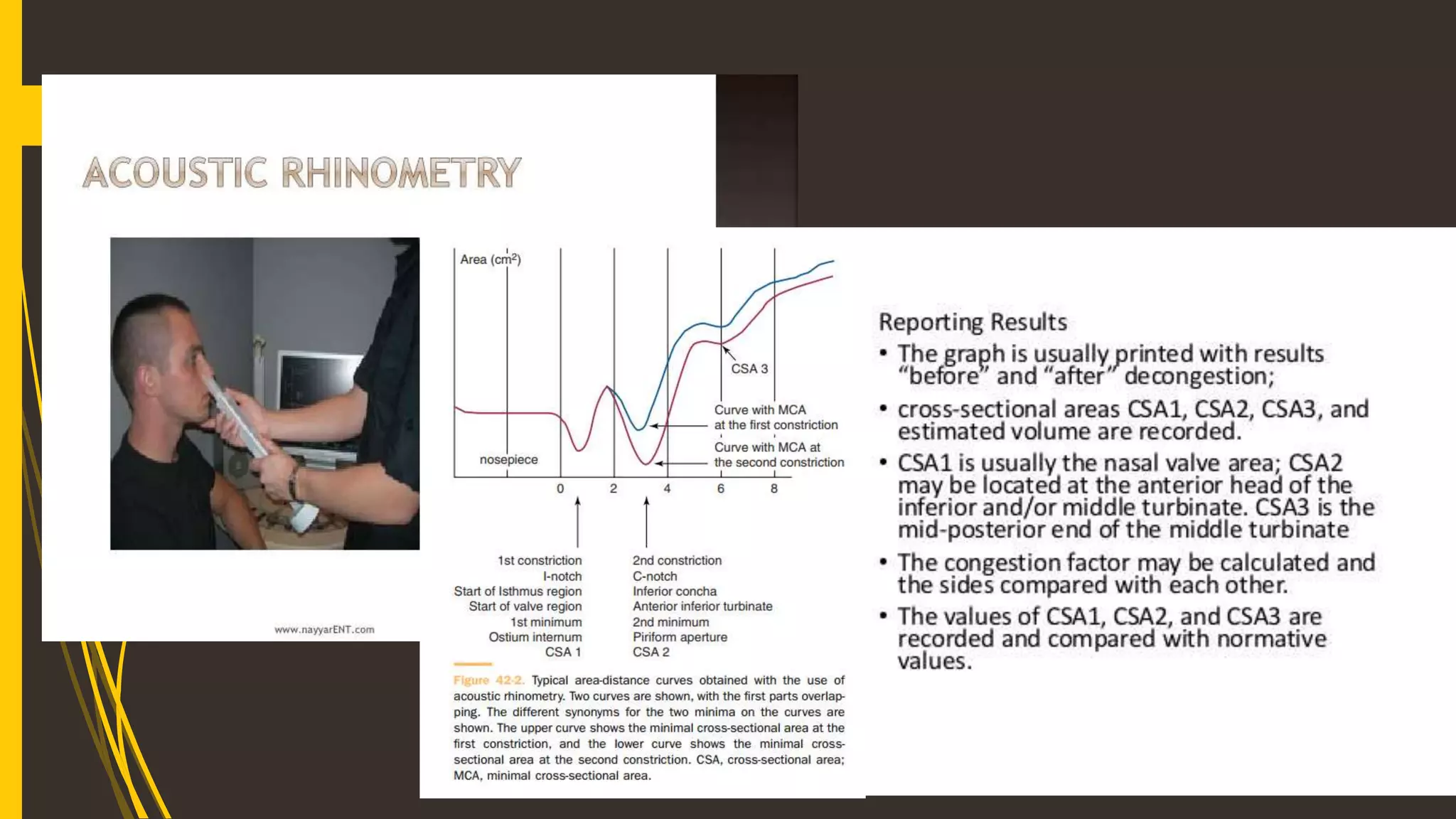 Nasal & paranasal sinus physiology beba | PPTX