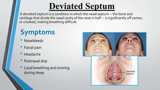 Nasal passage diseases | PPTX