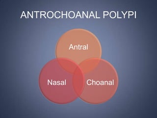 Nasal polyp kmct | PPT