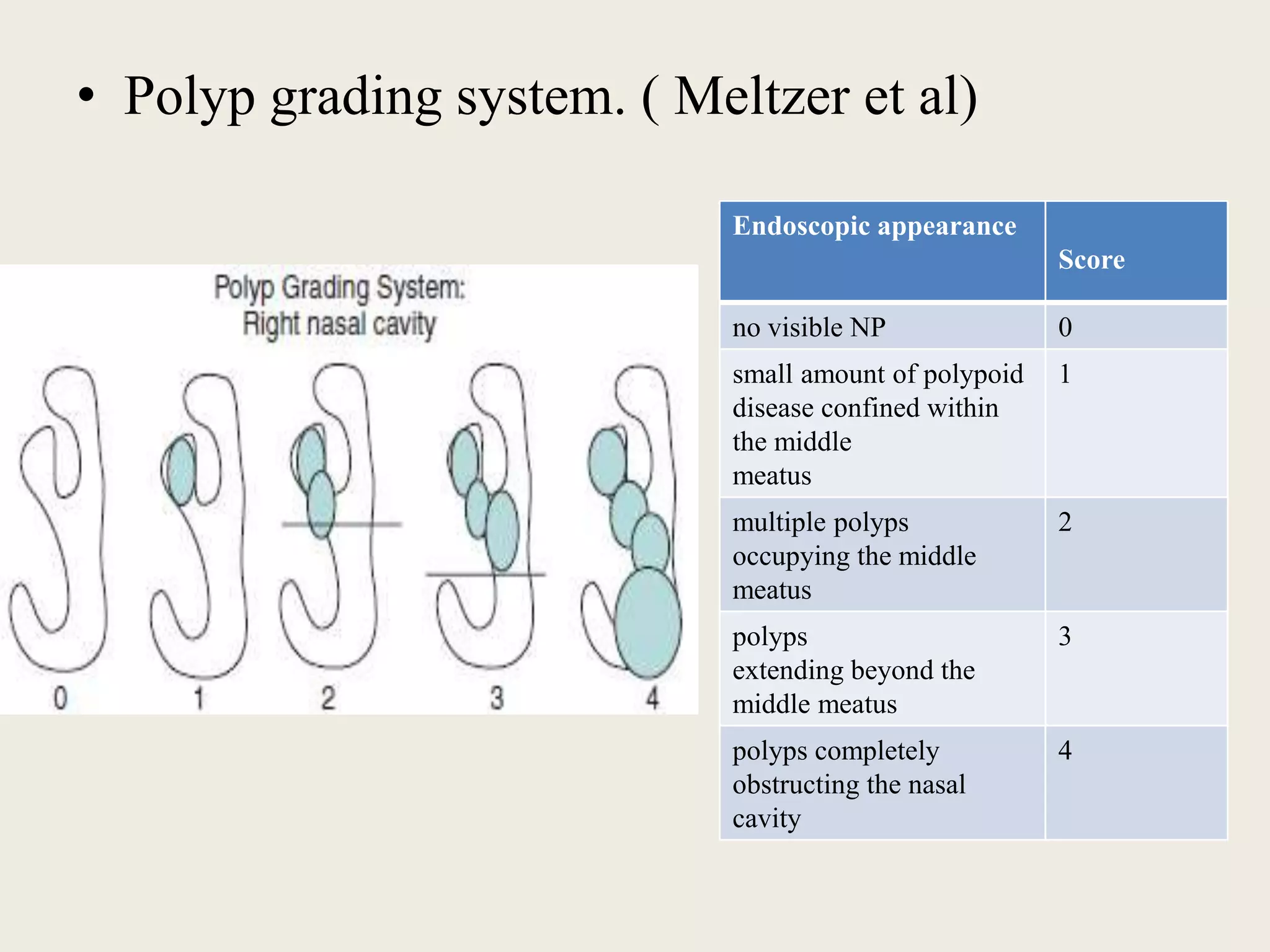 Nasal polyp | PPTX