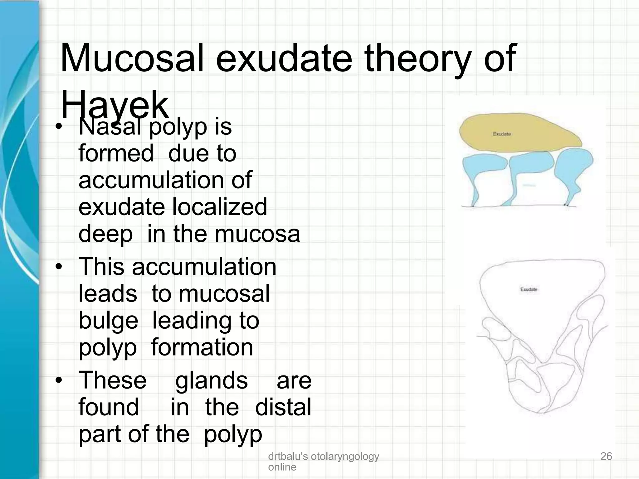 Nasal Polyps: etiology,pathogenesis,clinical features,management | PPTX ...