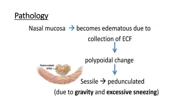 Nasal polyp antrochoanal polyp ethmoid polyp | PPTX