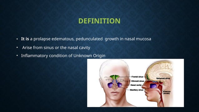NASAL POLYP.pptx defintion ,cause treatment | PPTX