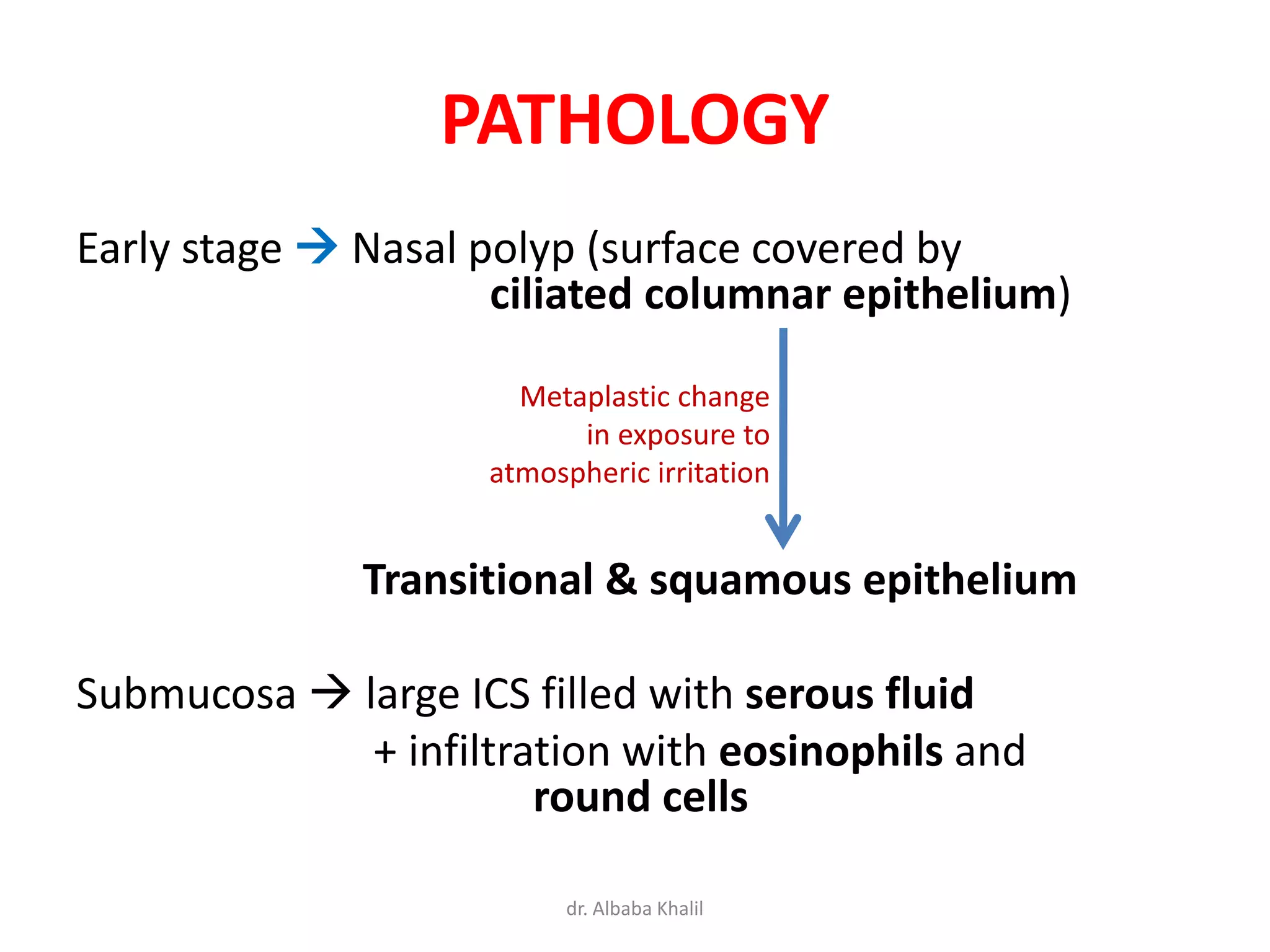 nasal polyp abu zneid.pptx
